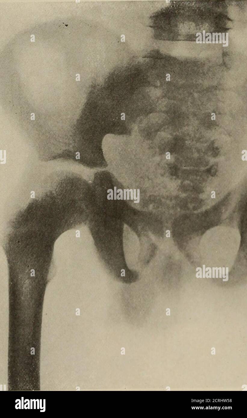 . Living anatomy and pathology; . FIG. 2.. s Stock Photo - Alamy