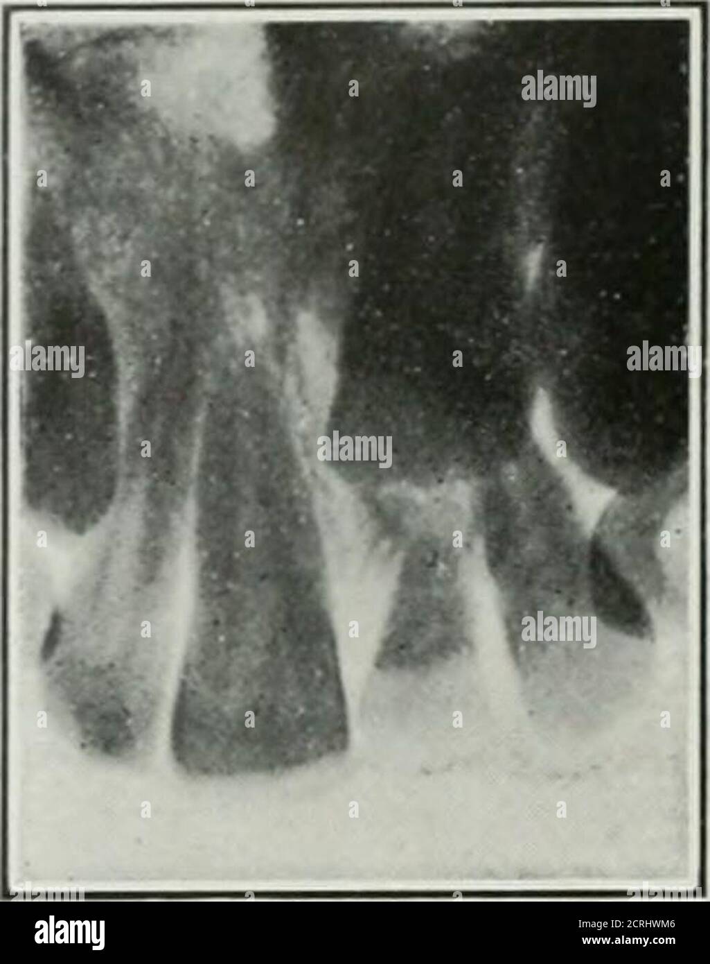 . The Roentgen rays in medicine and surgery as an aid in diagnosis and ...