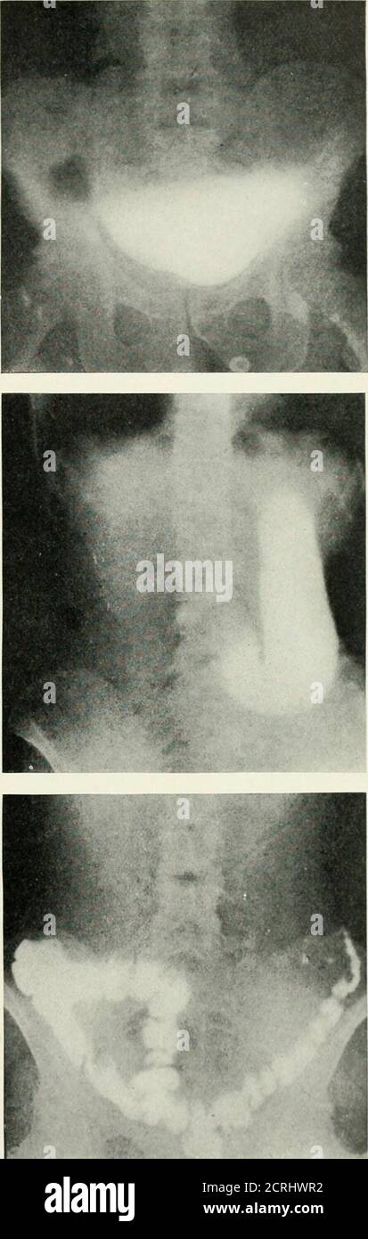 . Radiography, X-ray therapeutics and radium therapy . PLATE XLV ...