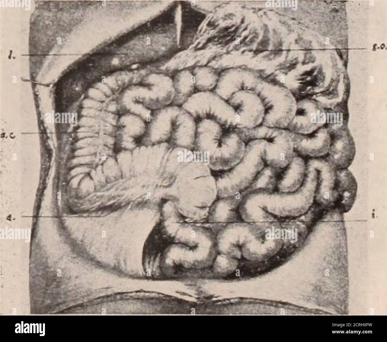 Intestinal umbilical loop hi-res stock photography and images - Alamy