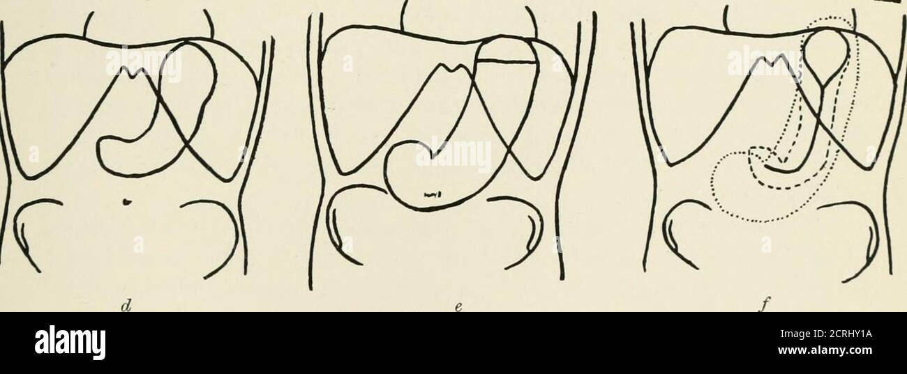 . Radiography, X-ray therapeutics and radium therapy . / Fig. 165 ...