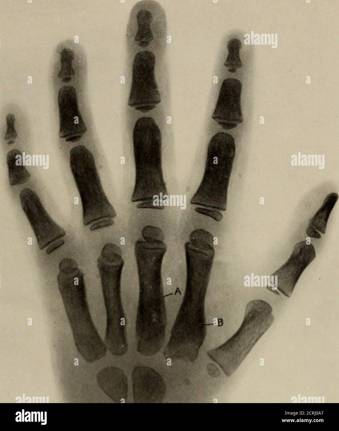 . Living anatomy and pathology; . PLATE 205.INFECTIOUS ARTHRITIS OF THE ...