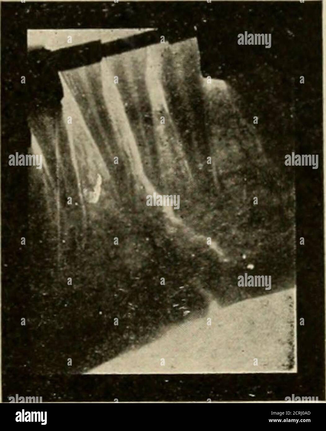 . Elementary and dental radiography / by Howard Riley Raper . on showed ...
