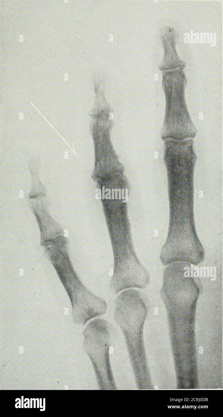 Boy gives report hi-res stock photography and images - Alamy