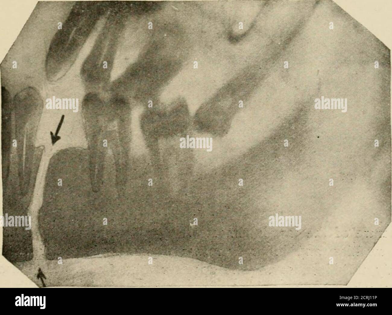 . Elementary and dental radiography / by Howard Riley Raper . Fig. 280 ...