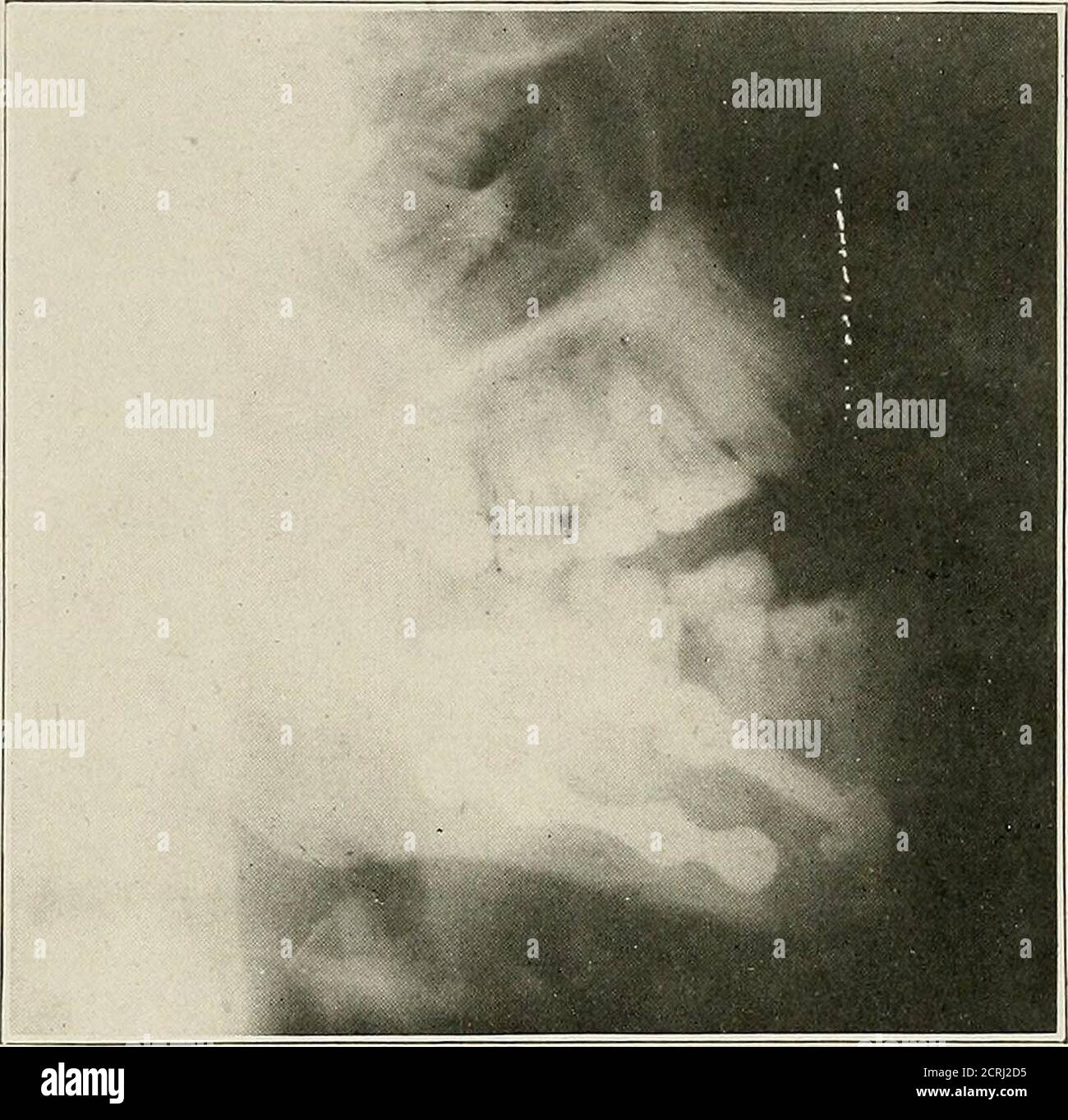 . Interpretation of dental and maxillary roentgenograms . Fig. 257 ...