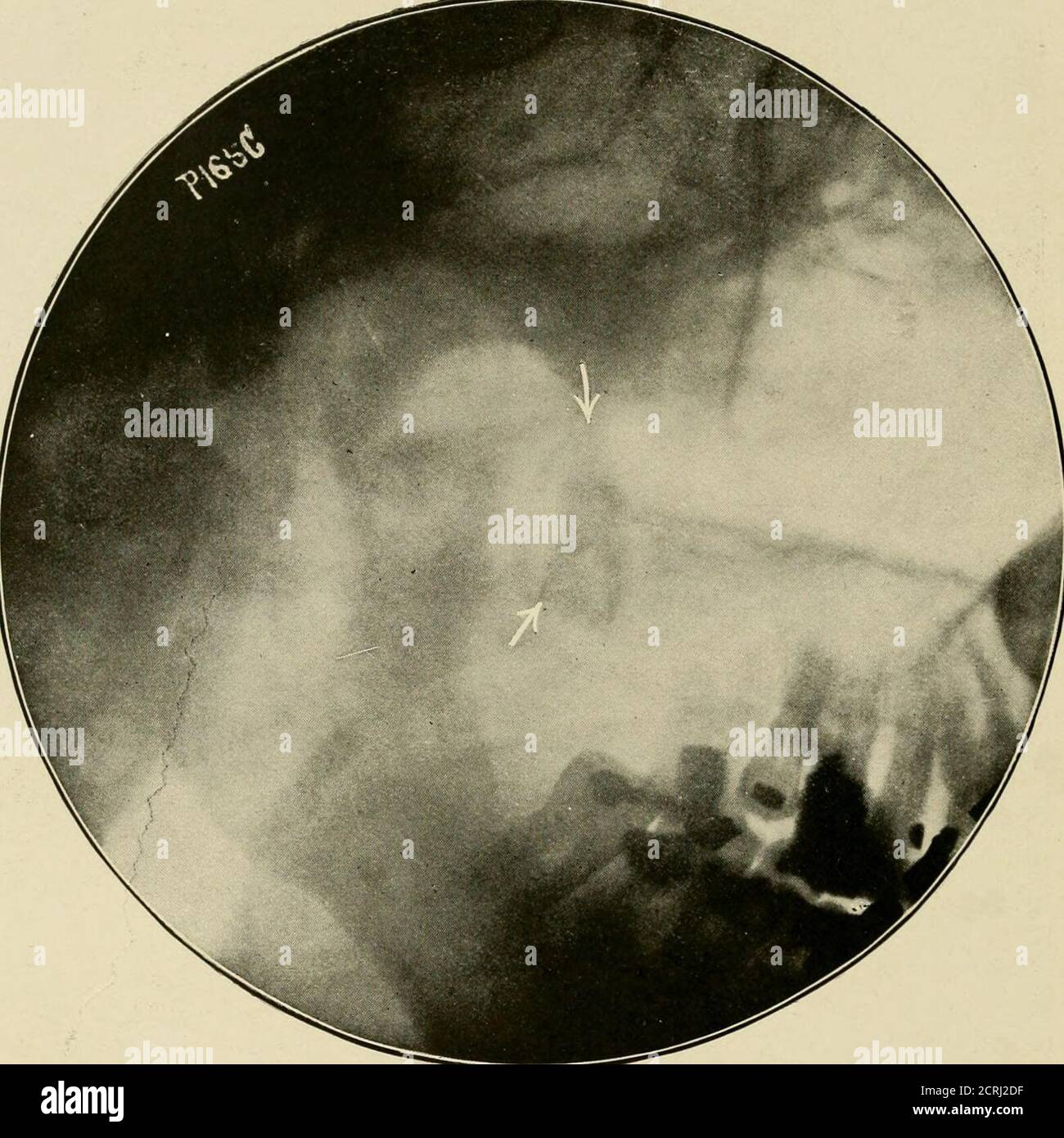 . Elementary and dental radiography / by Howard Riley Raper . Fig. 273 ...