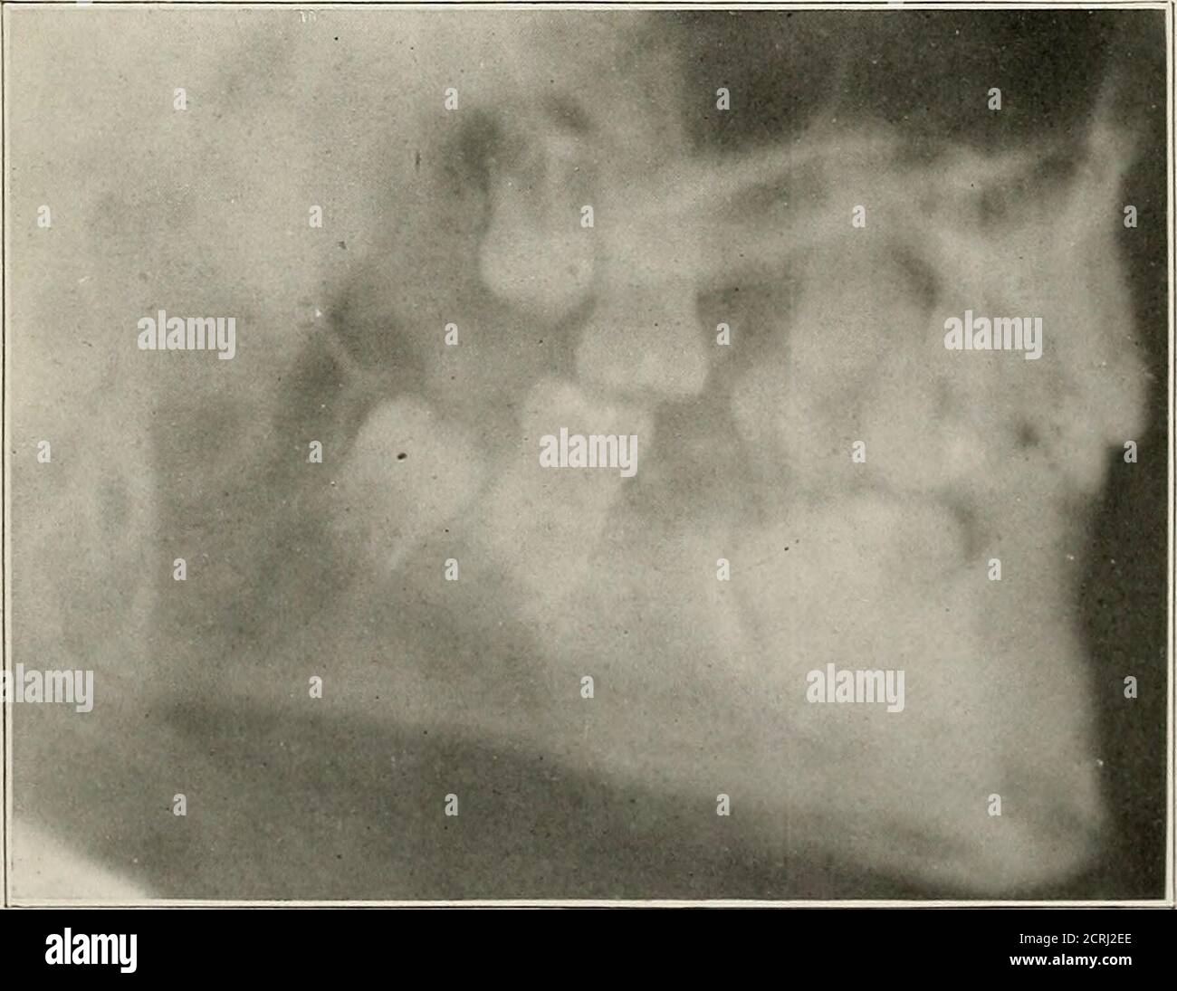 . Interpretation of dental and maxillary roentgenograms . Fig. 252 ...