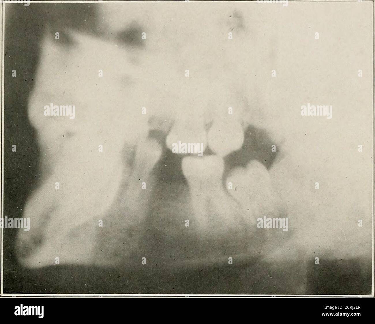 . Interpretation of dental and maxillary roentgenograms . Fig. 251 ...