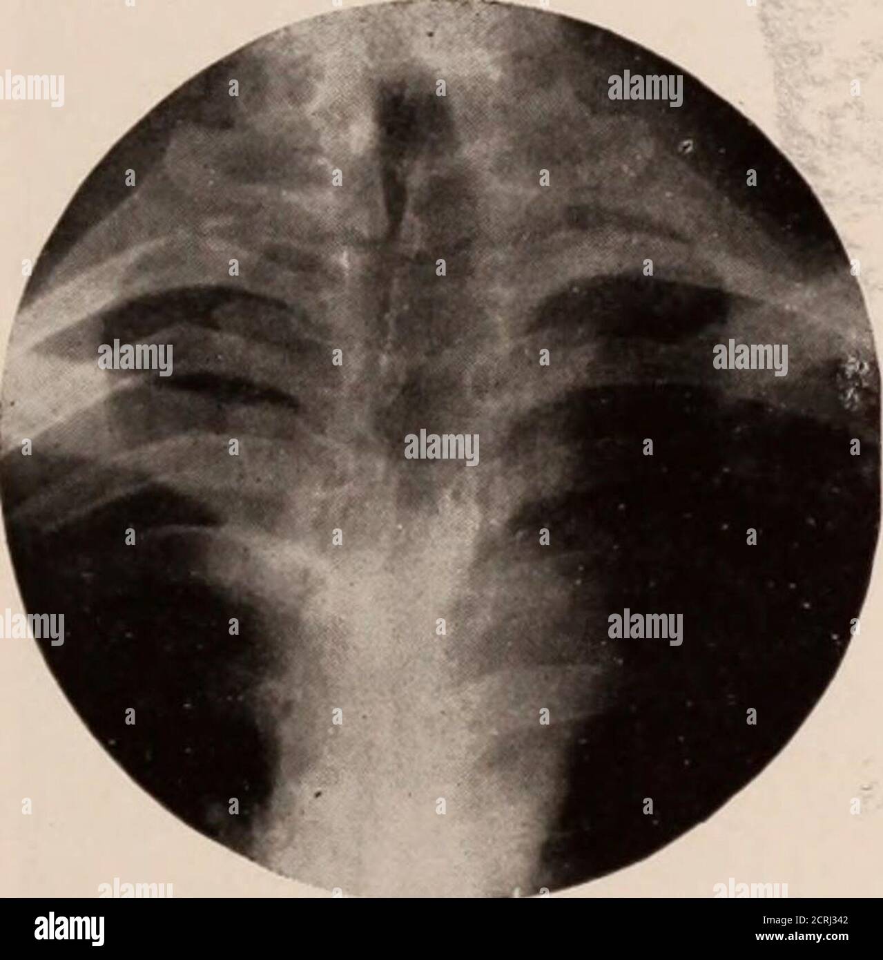 Ala of sacrum hi-res stock photography and images - Alamy