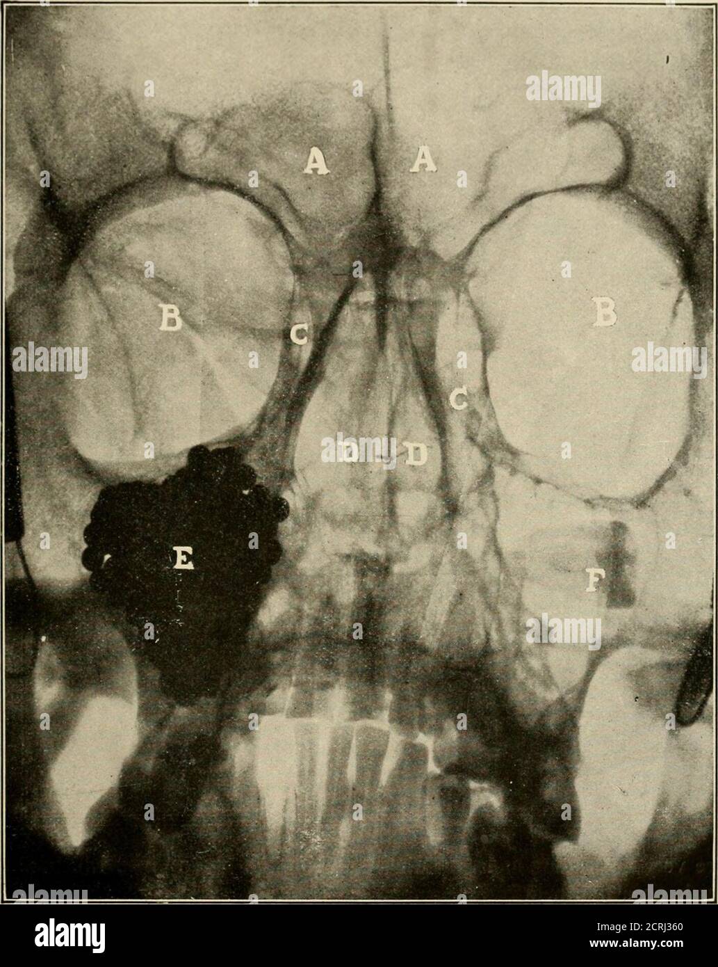 . Elementary and dental radiography / by Howard Riley Raper . that ...