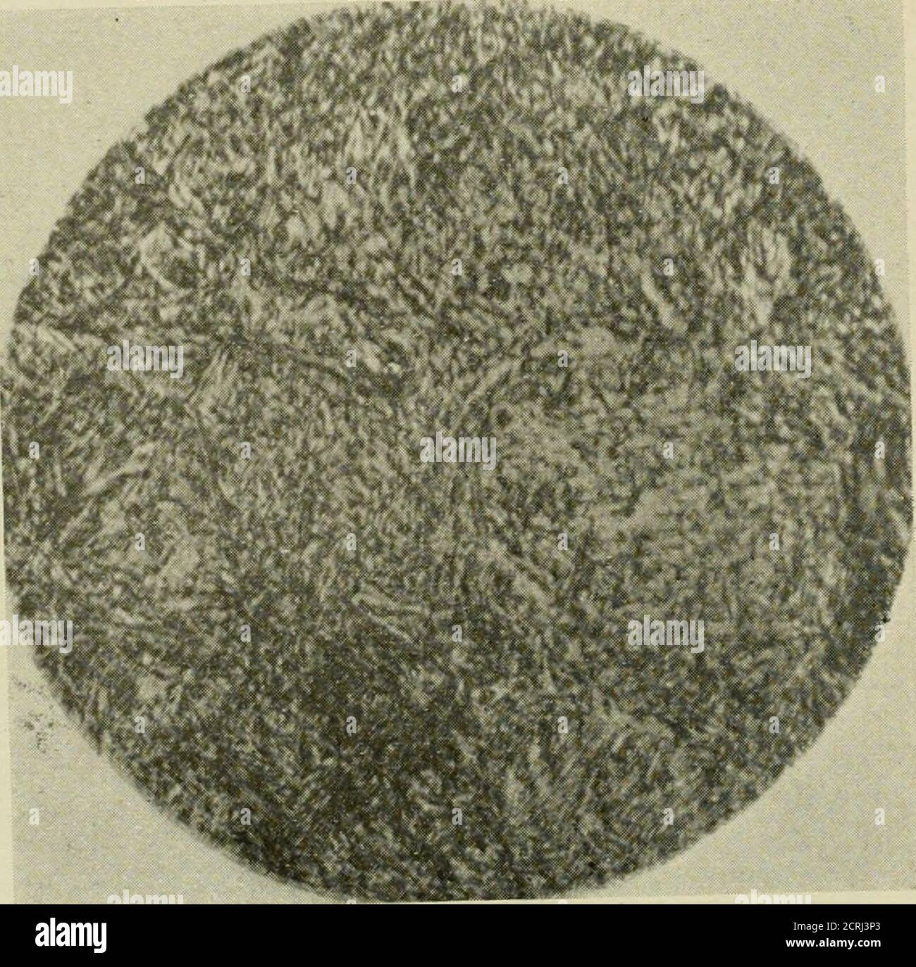 Pearlite structure hi-res stock photography and images - Alamy