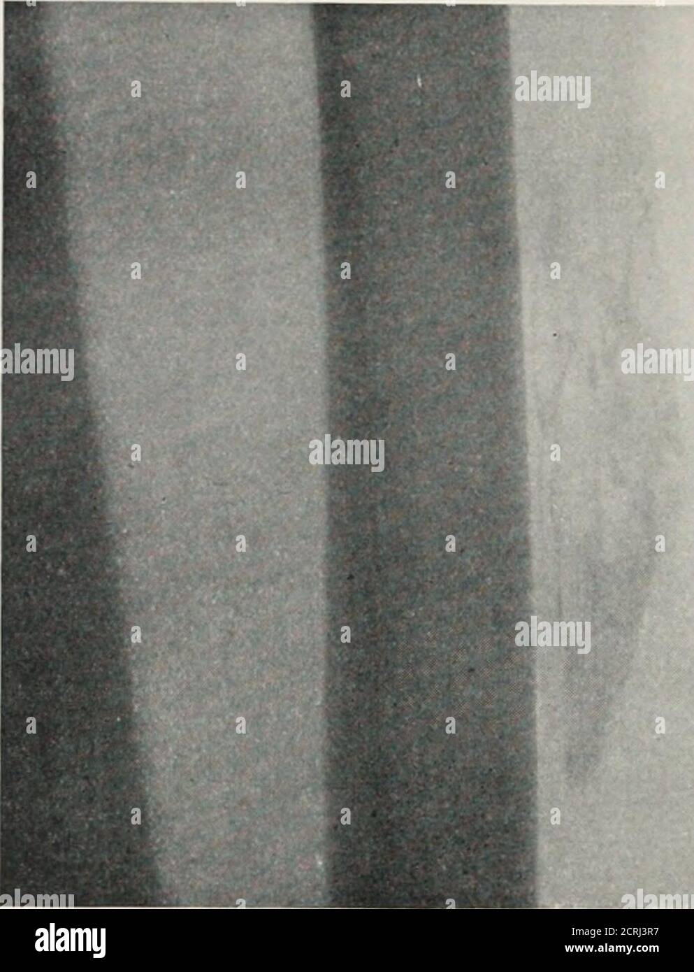 . Radiography, X-ray therapeutics and radium therapy . the shaft of a ...