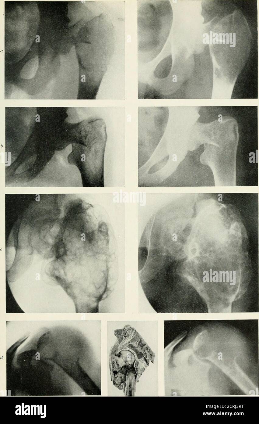. Radiography, X-ray therapeutics and radium therapy . ssificans Note ...