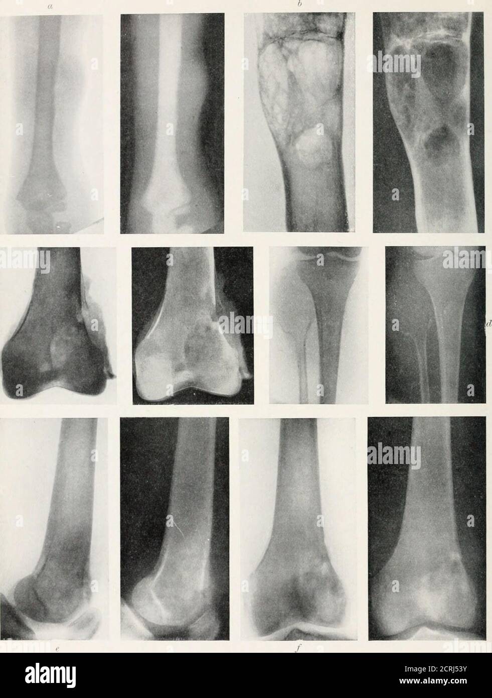 . Radiography, X-ray therapeutics and radium therapy . Fig. 147 ...