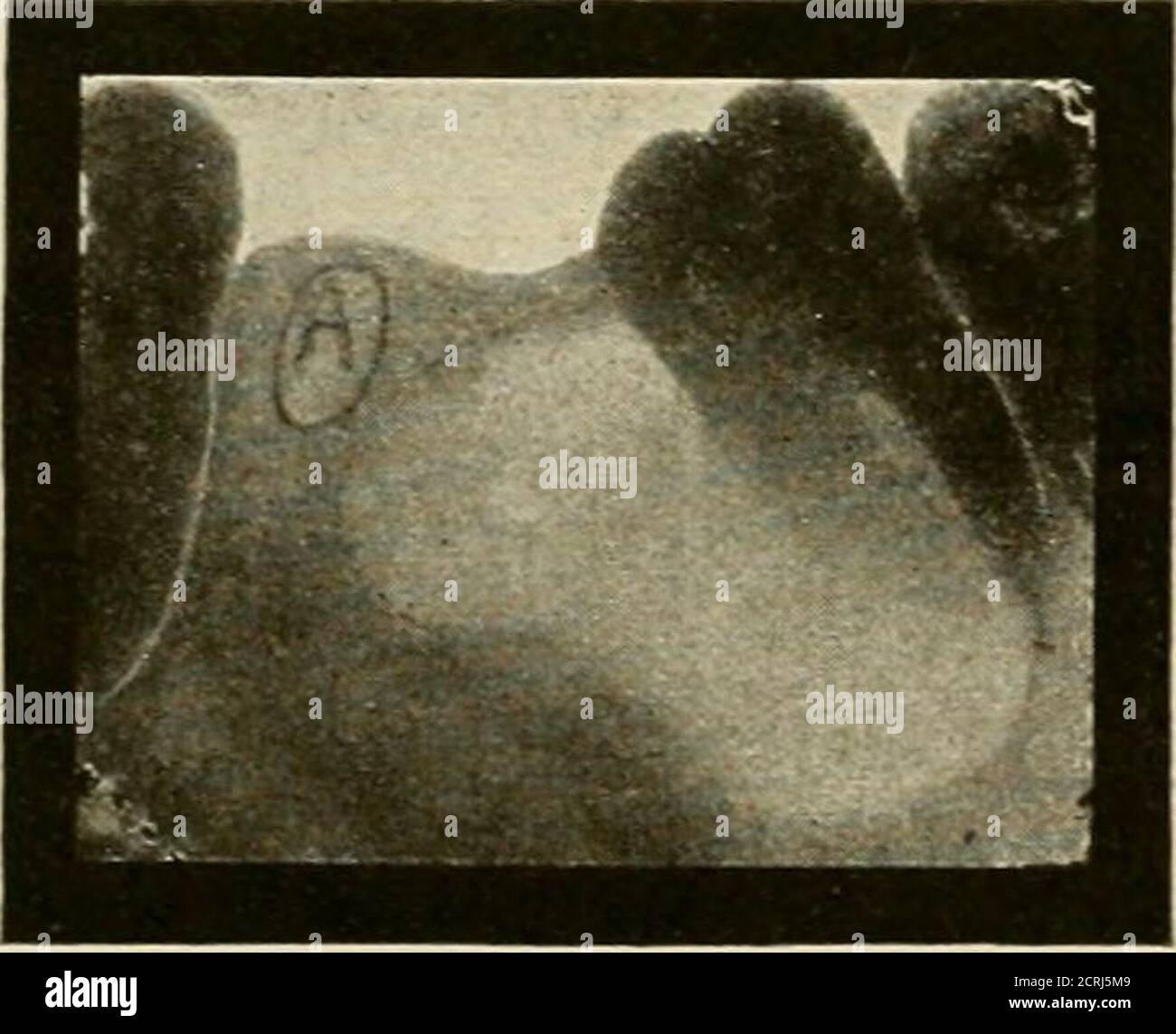 . Elementary and dental radiography / by Howard Riley Raper . Fig. 252 ...