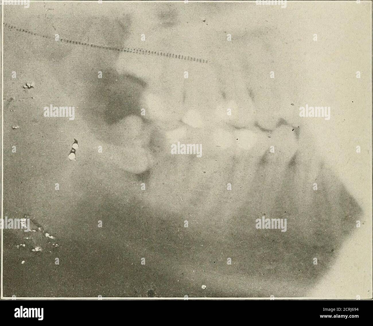 . Interpretation of dental and maxillary roentgenograms . A. B. Fig ...