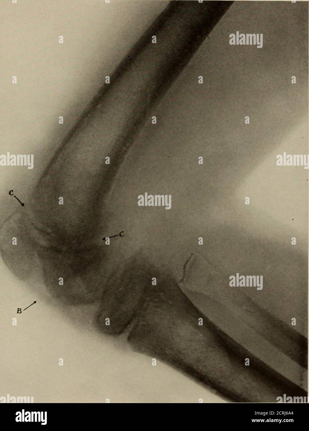 . Living anatomy and pathology; . PLATE 179. BACKWARD DISPLACEMENT OF ...