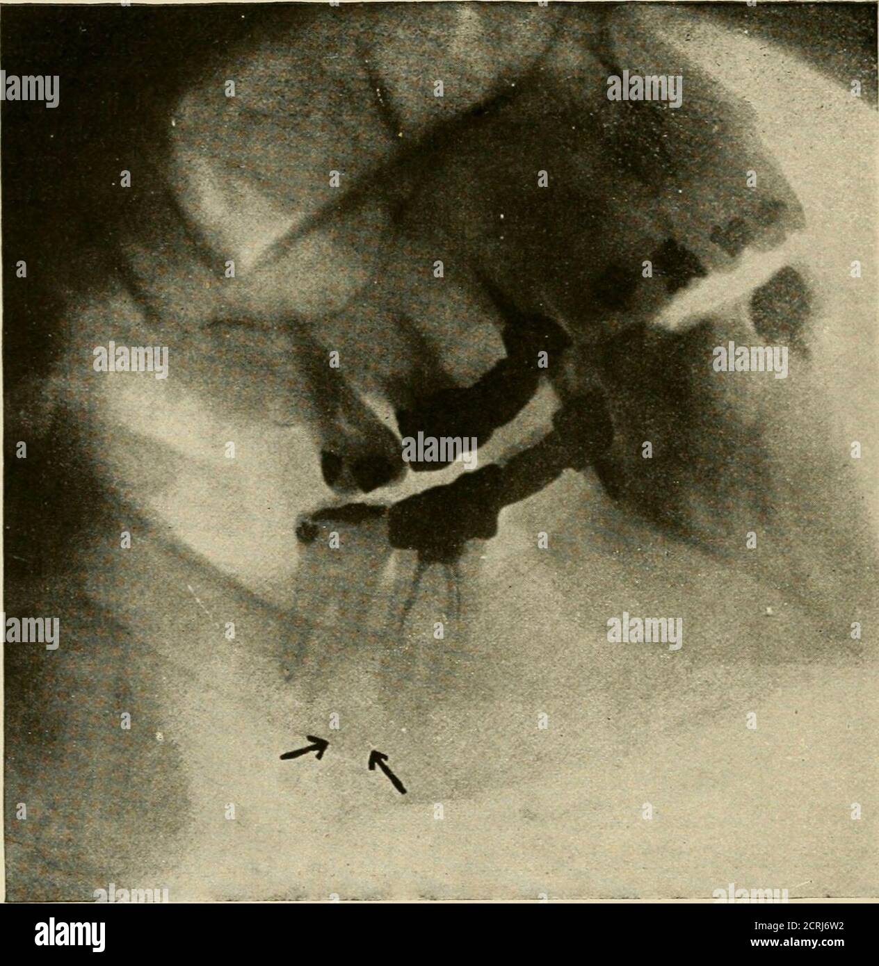 . Elementary and dental radiography / by Howard Riley Raper . Fig. 246 ...