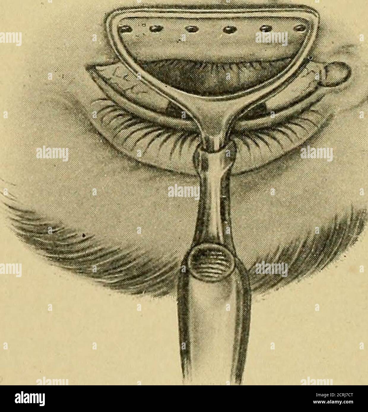 Entropion High Resolution Stock Photography and Images - Alamy