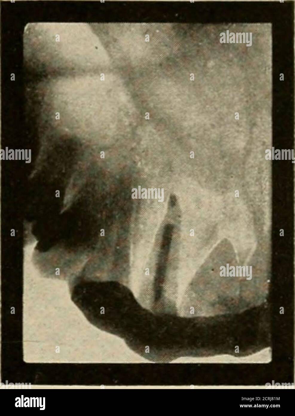 . Elementary and dental radiography / by Howard Riley Raper . Fig. 241 ...