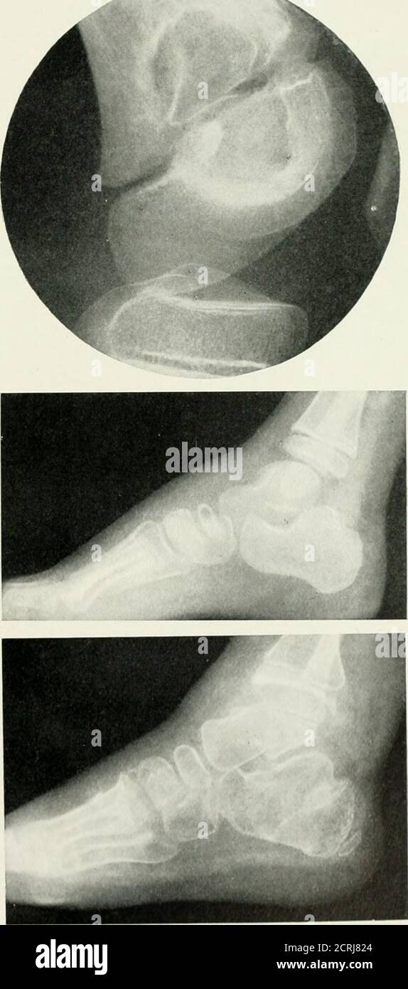 Radiography, X-ray therapeutics and radium therapy . PLATE .Y ...