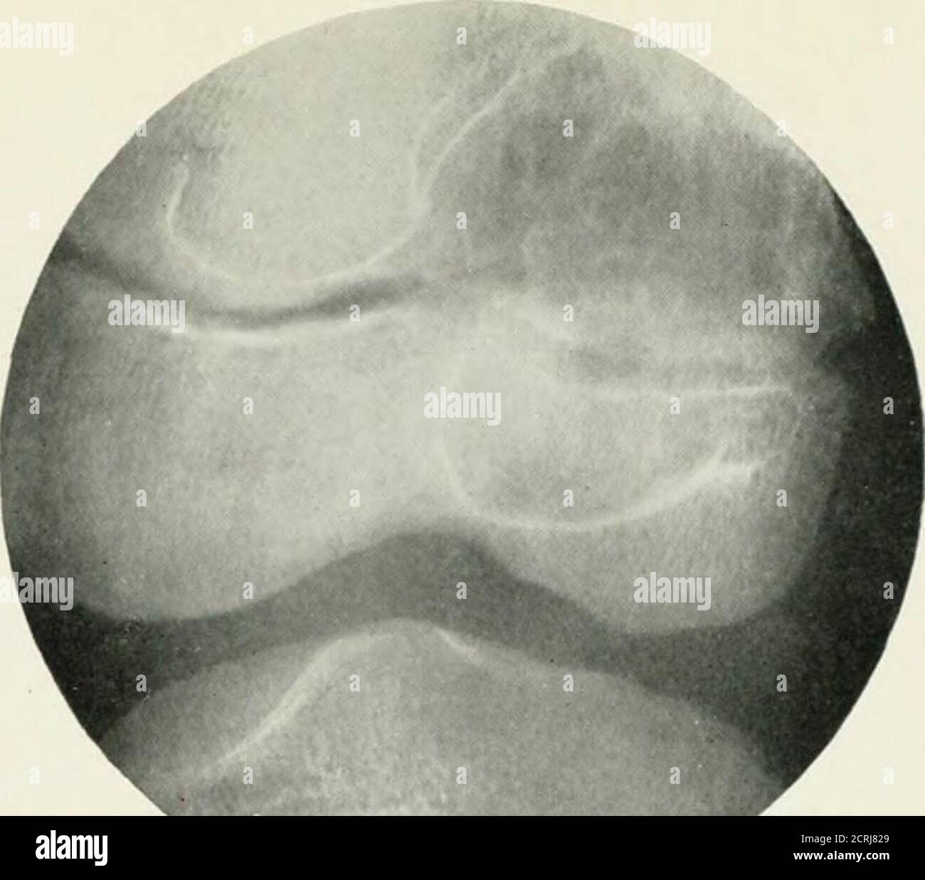 . Radiography, X-ray therapeutics and radium therapy Stock Photo - Alamy