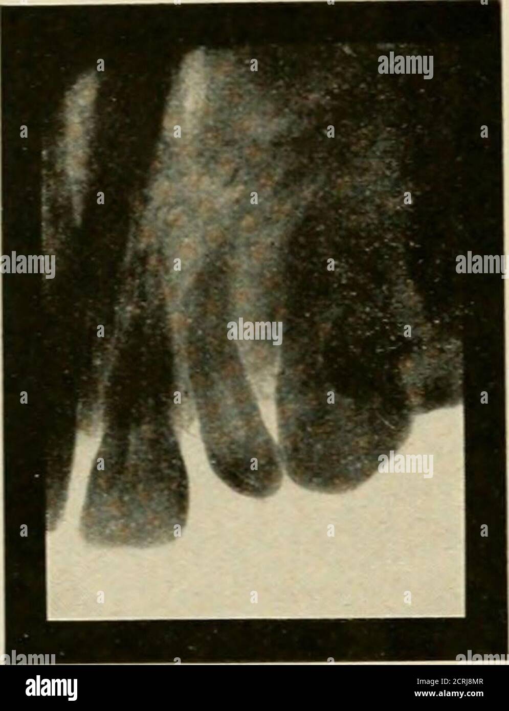 Porcelain jacket crown hi-res stock photography and images - Alamy