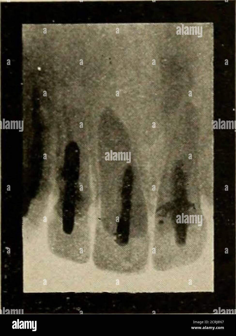 . Elementary and dental radiography / by Howard Riley Raper . a ...