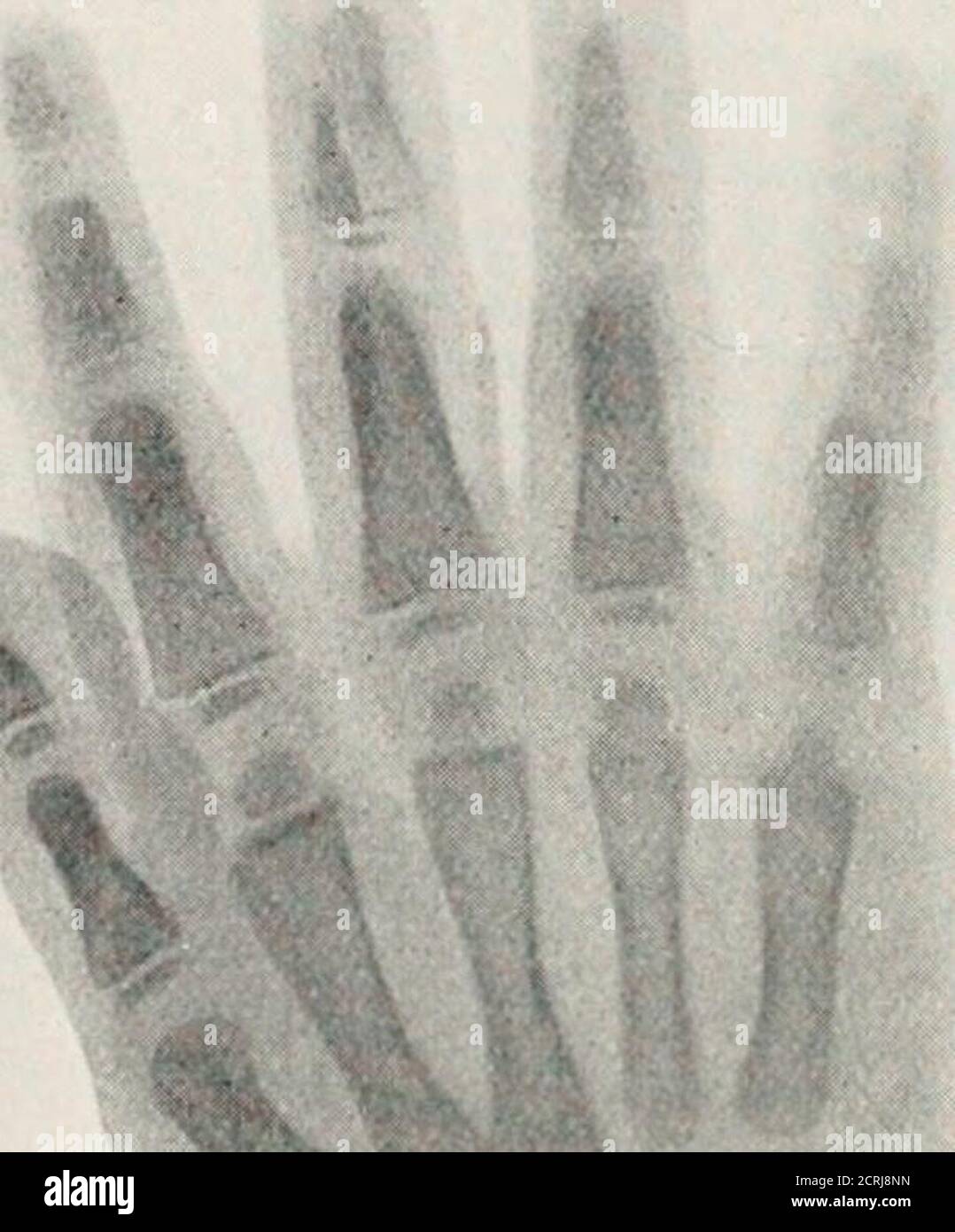. Radiography, X-ray therapeutics and radium therapy . onsequence. The ...