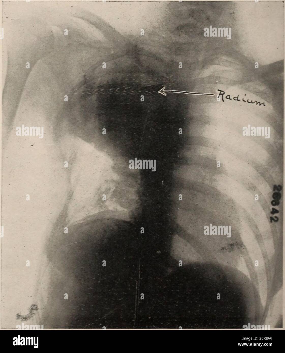 Radium vita hi-res stock photography and images - Alamy