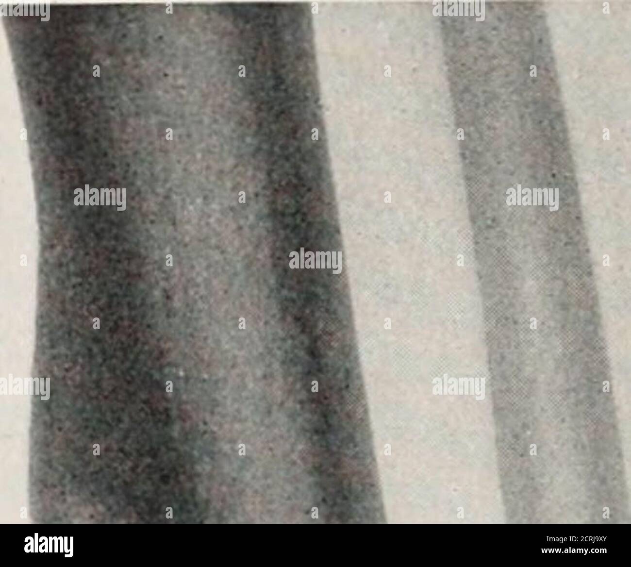 . Radiography, X-ray therapeutics and radium therapy . rate, and ...