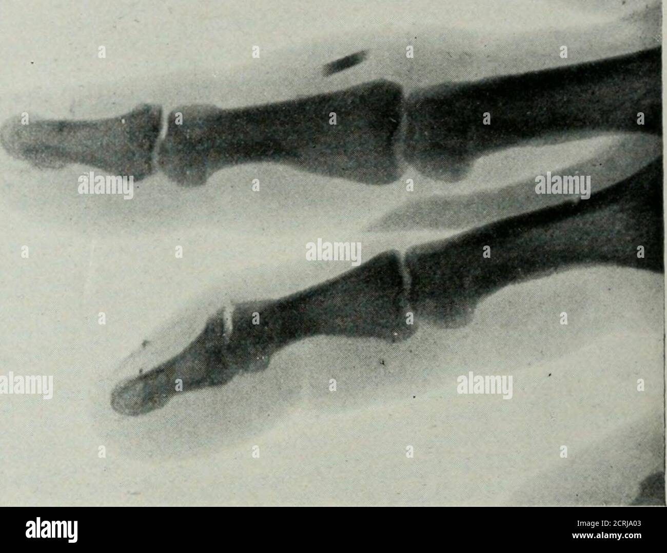 Various iron fragments hi-res stock photography and images - Alamy