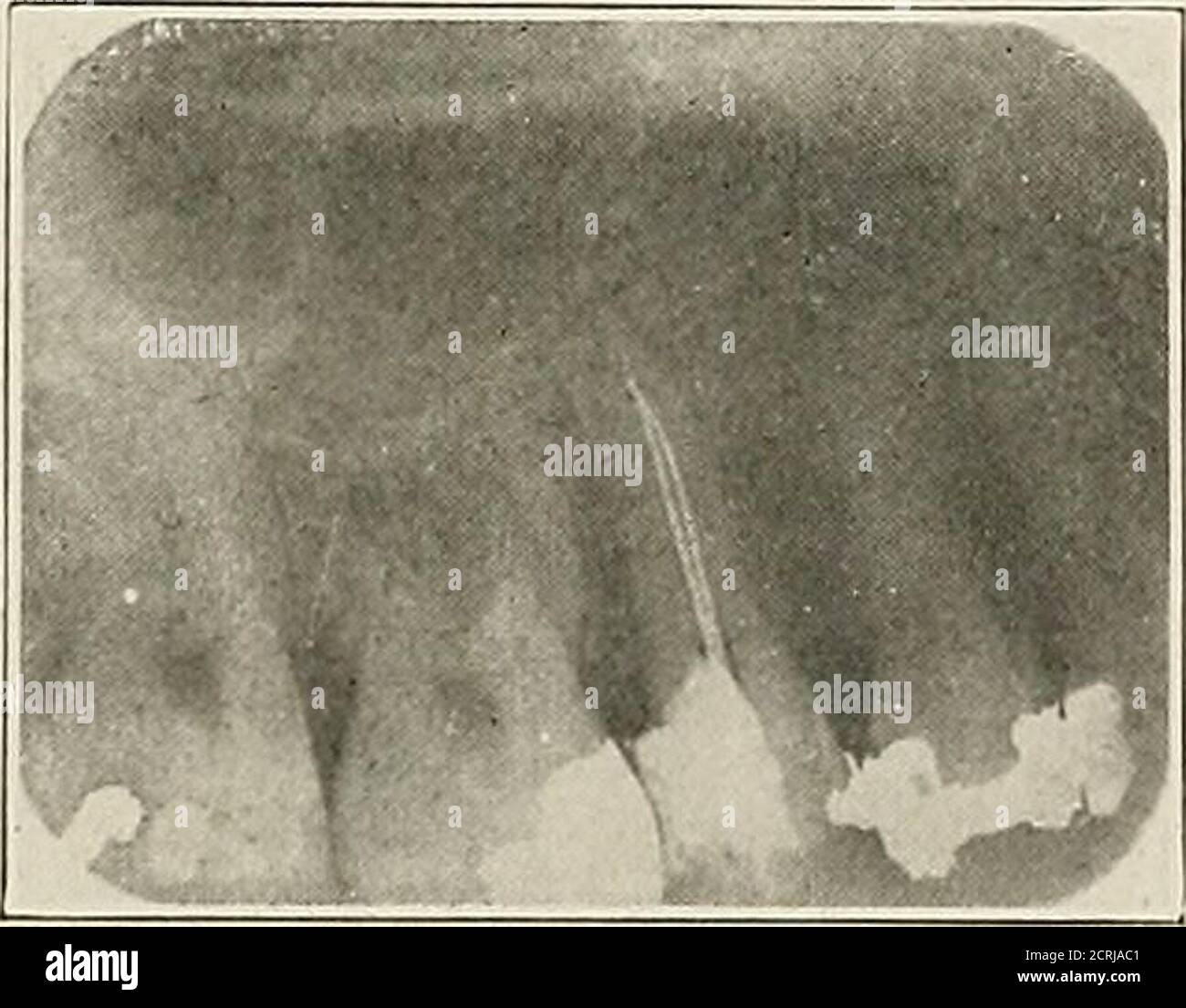. Interpretation of dental and maxillary roentgenograms . c. Fig. 212 ...