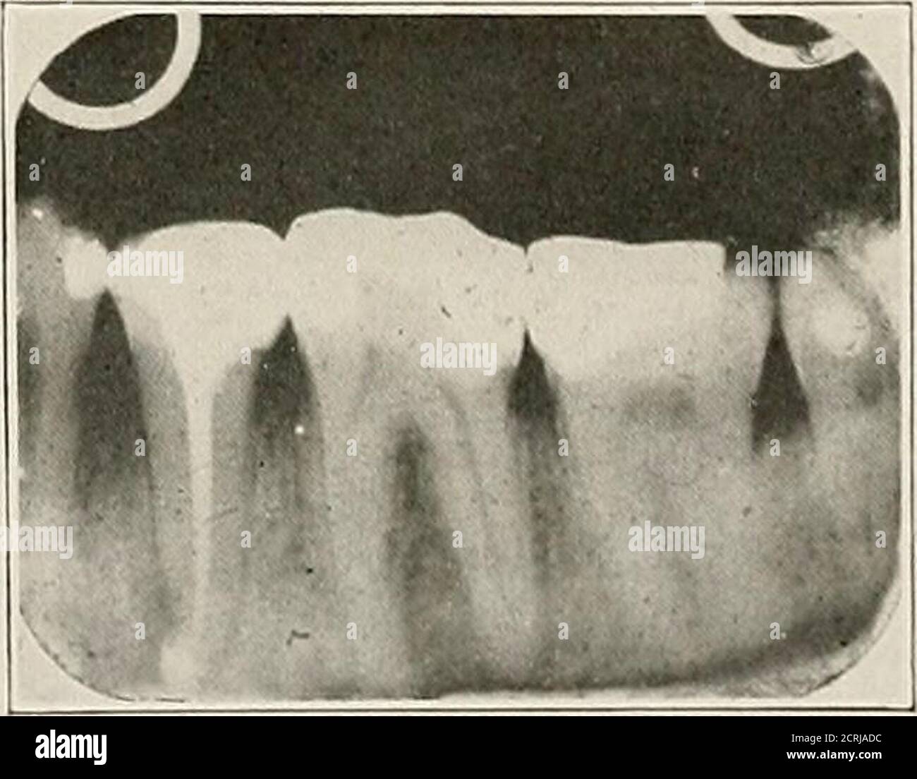 . Interpretation of dental and maxillary roentgenograms . Fig. 211.—A ...