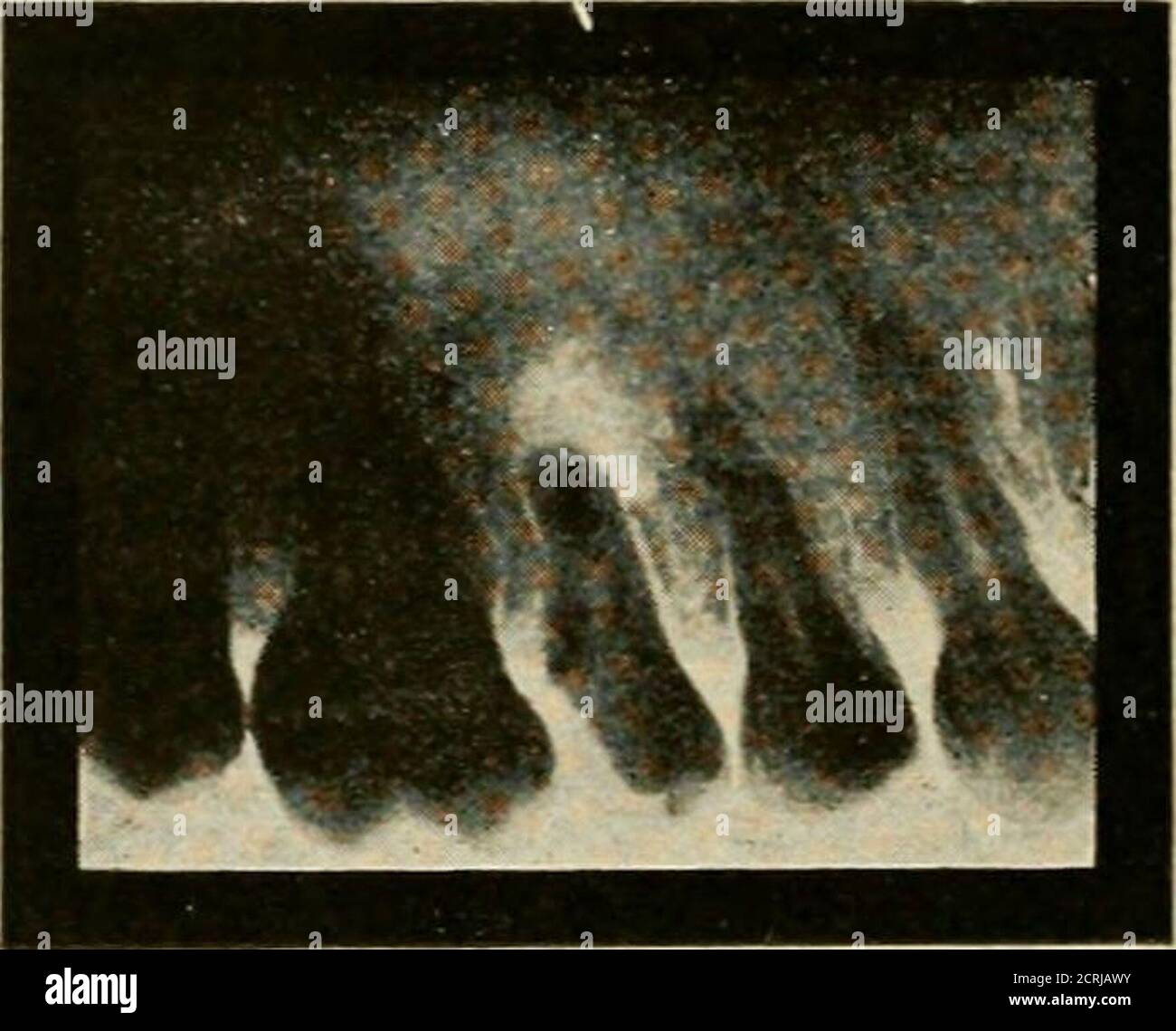 Apical Foramen High Resolution Stock Photography and Images - Alamy