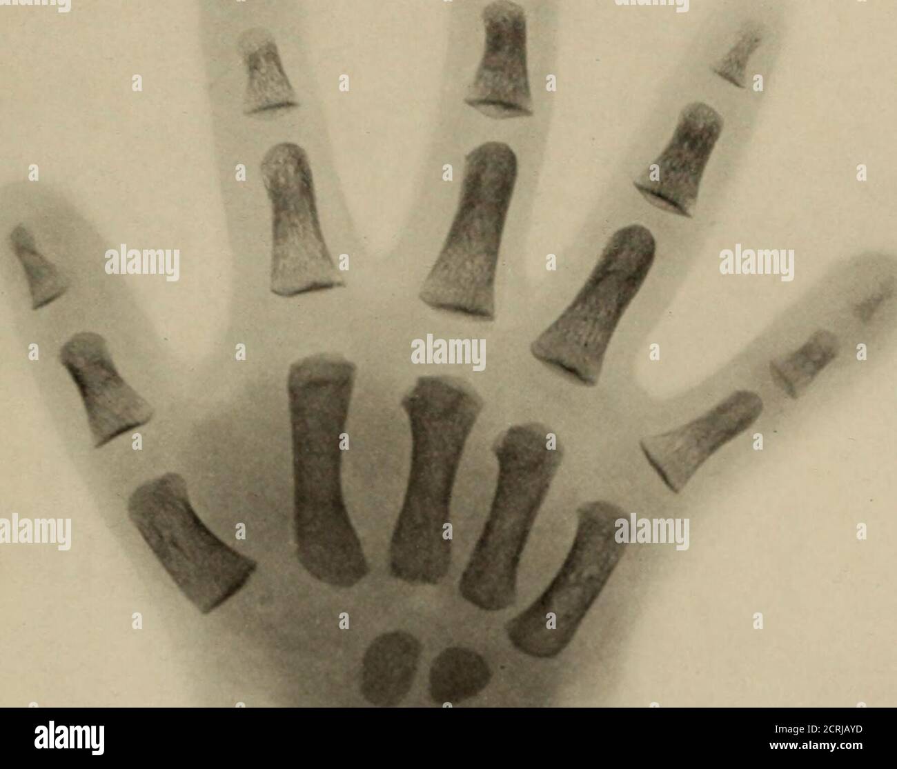 . Living anatomy and pathology; . centre of these areas. Sometimes the ...