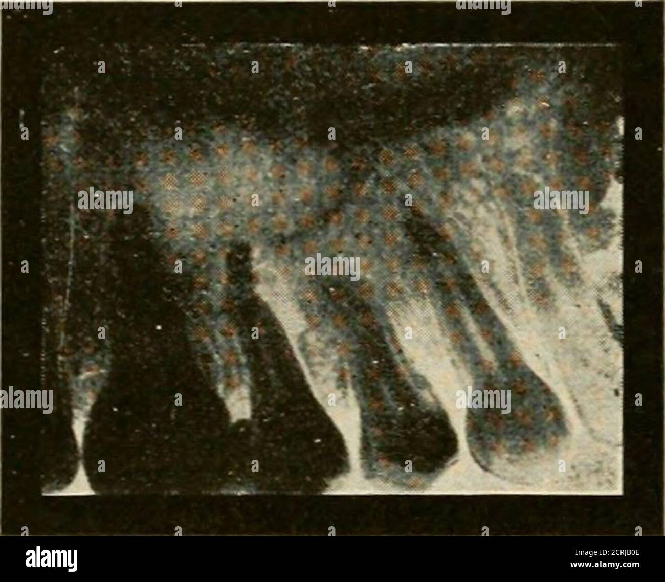 Bismuth 211 hi-res stock photography and images - Alamy