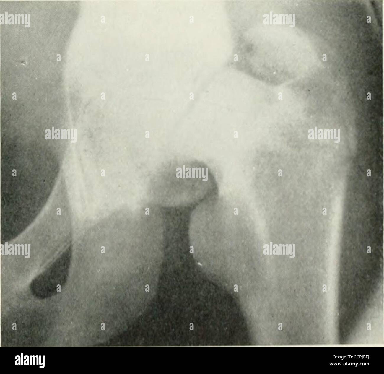 . Radiography, X-ray therapeutics and radium therapy . PLATK XVI ...