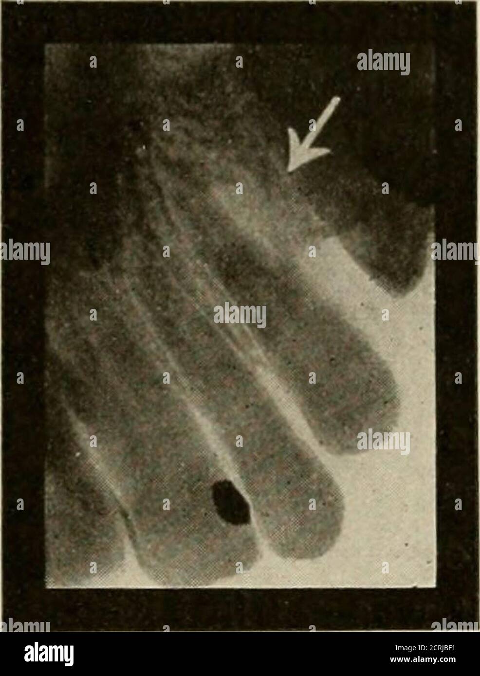 . Elementary and dental radiography / by Howard Riley Raper . Fig. 207 ...