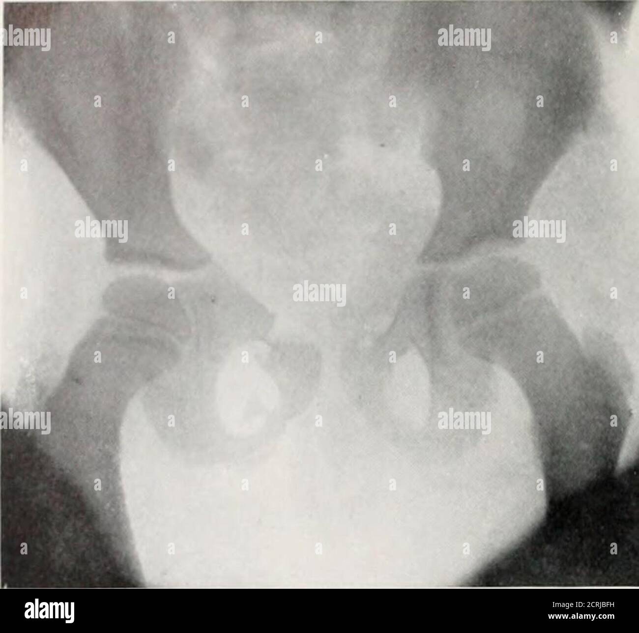 . Radiography, X-ray therapeutics and radium therapy . PLATK XVI ...