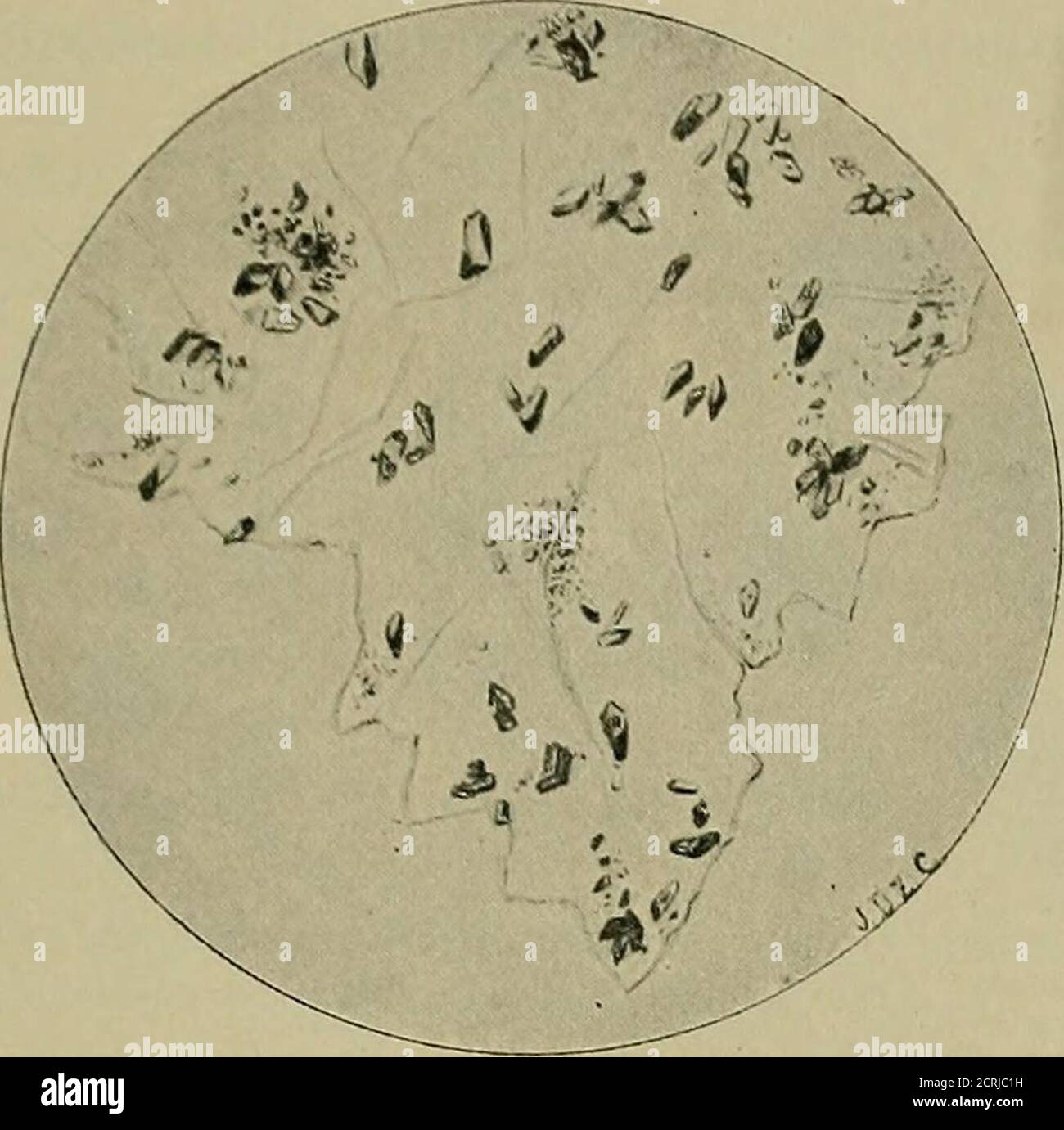 Amorphous Phosphate Crystals