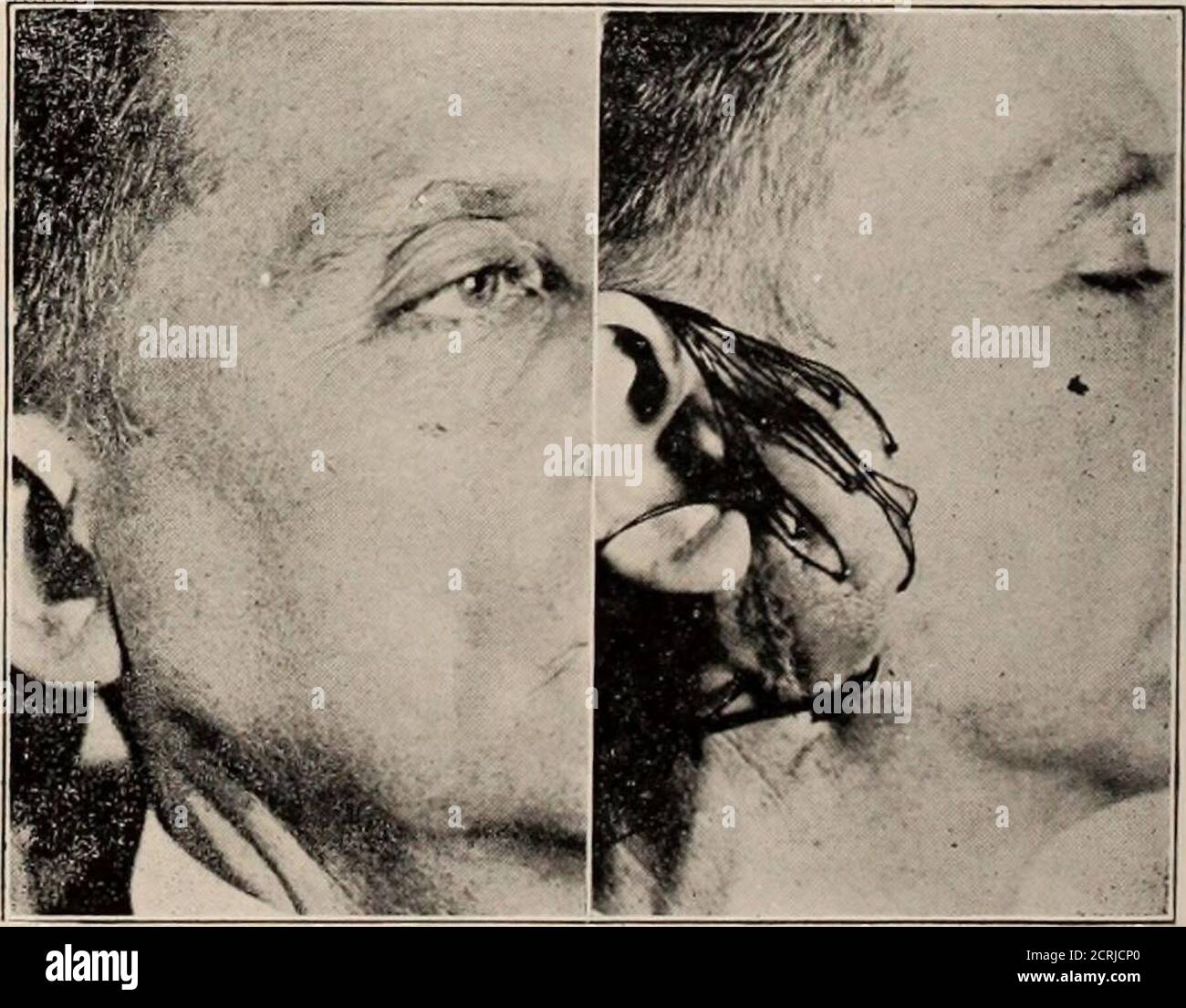 Mixoma hi-res stock photography and images - Alamy