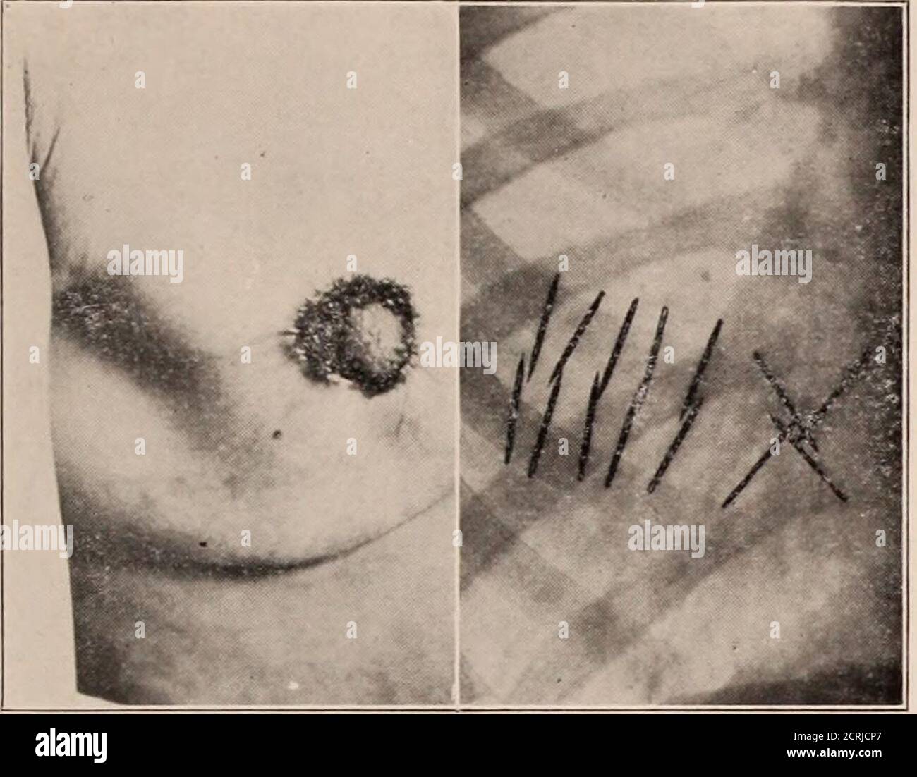 Mixoma hi-res stock photography and images - Alamy