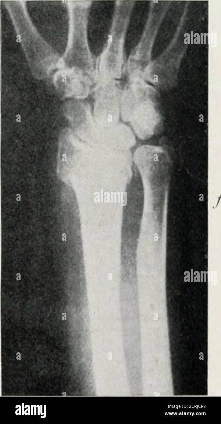 . Radiography, X-ray therapeutics and radium therapy . fl. ILAIE XIV ...