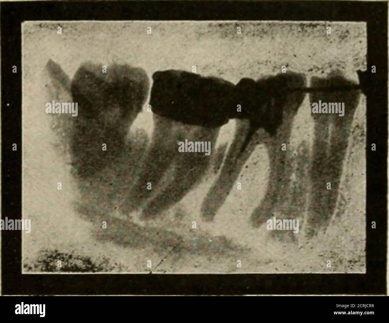 . Elementary and dental radiography / by Howard Riley Raper . Fig. 198 ...