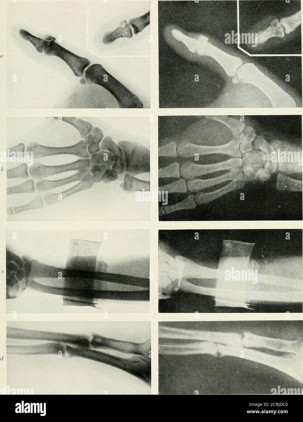 . Radiography, X-ray therapeutics and radium therapy . Antero-posterior ...