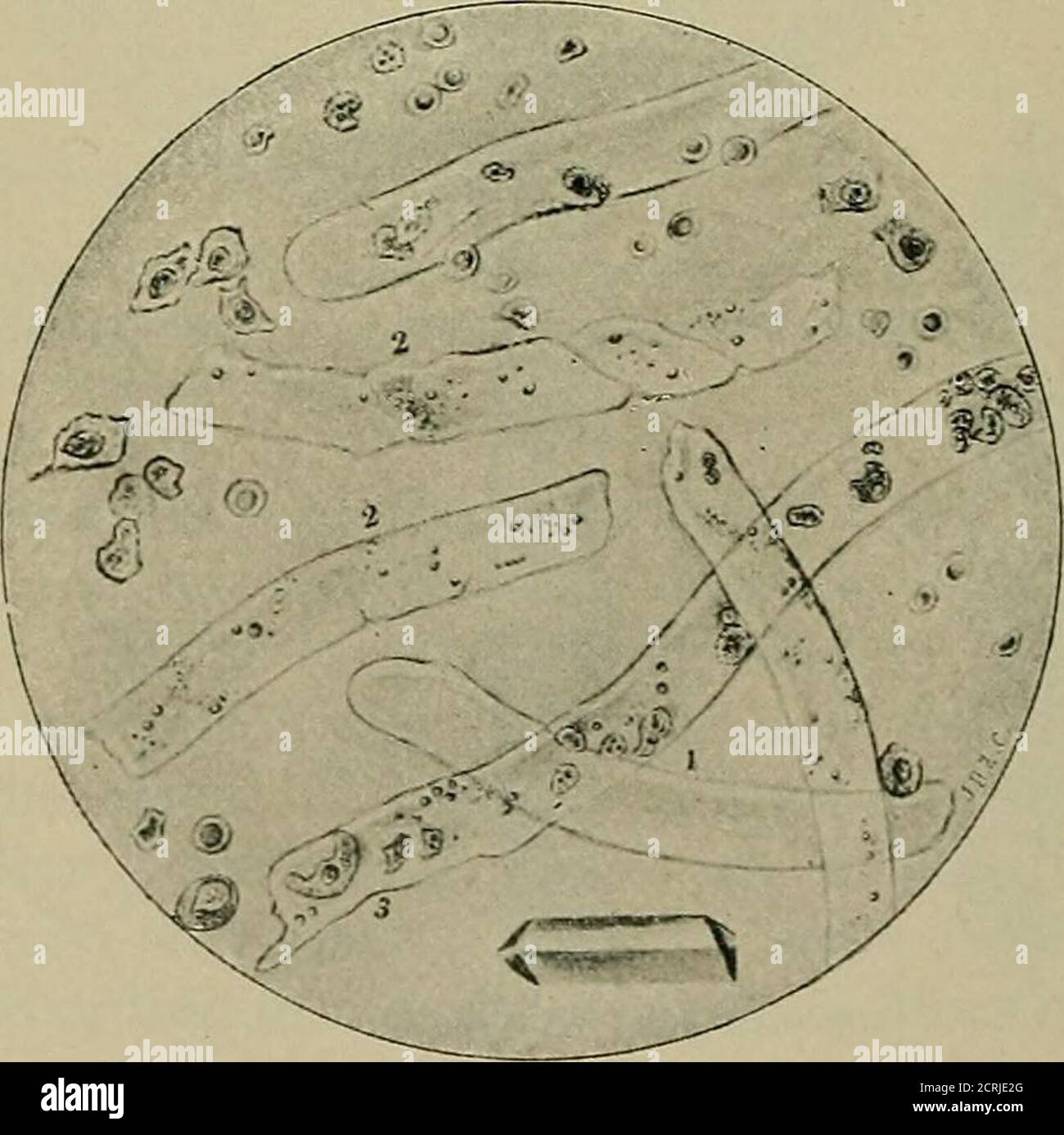 Urinary sediment hi-res stock photography and images - Alamy