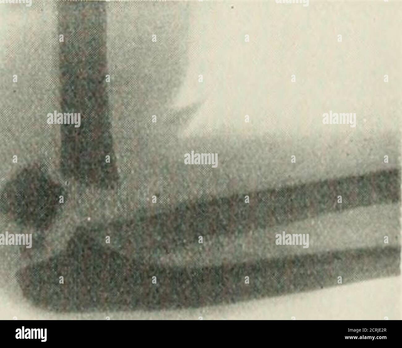 . Radiography, X-ray therapeutics and radium therapy . Fig. 133 ...