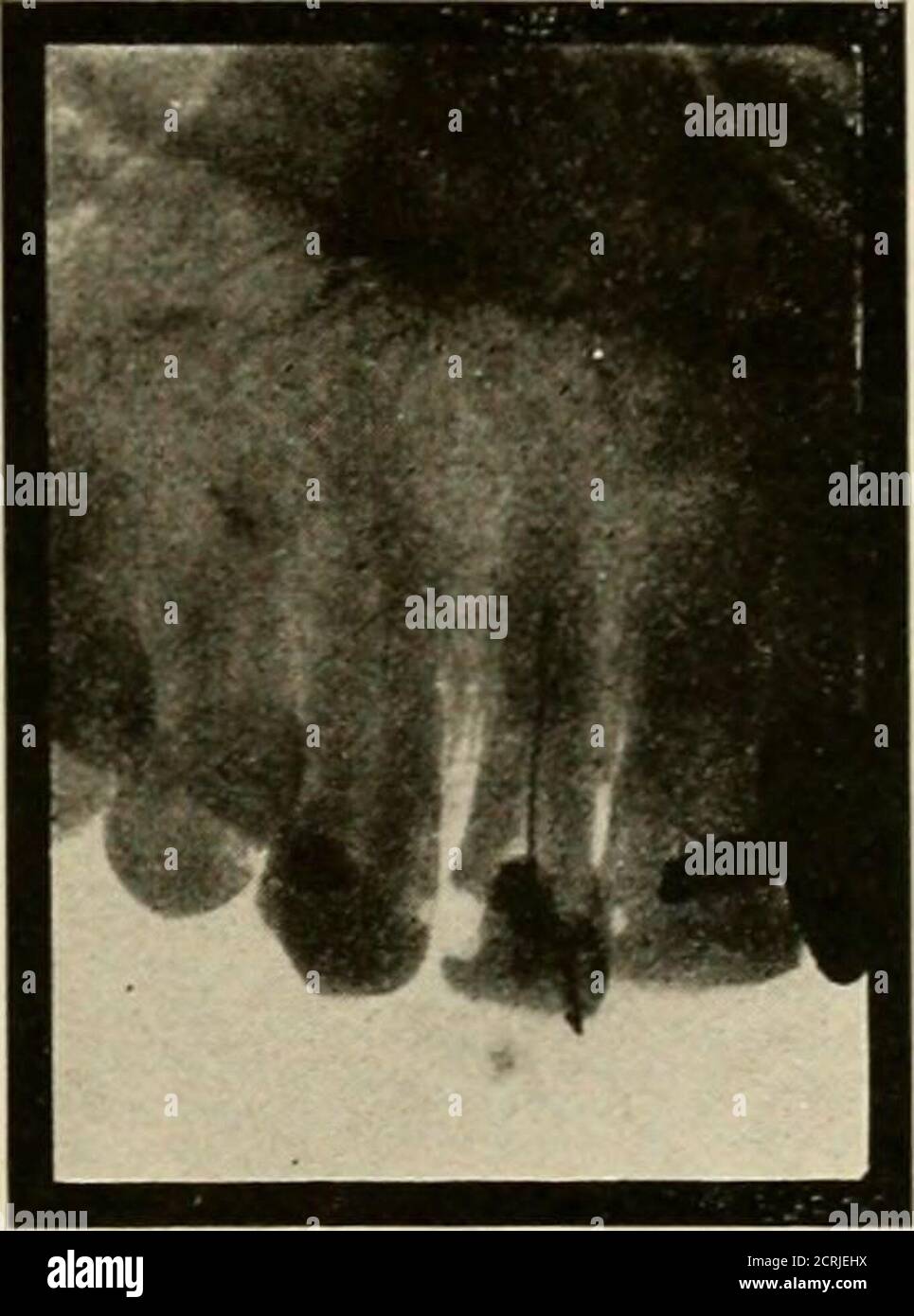 . Elementary and dental radiography / by Howard Riley Raper . Fig. 183 ...